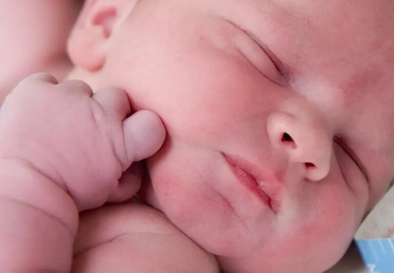 Bladder - UCI Pediatric Urology