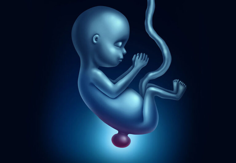 Spina Bifida - UCI Pediatric Urology